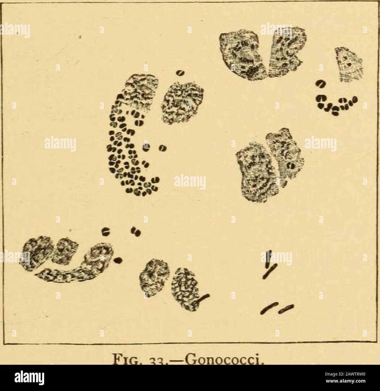 The diseases of women : a handbook for students and practitioners . nd ...