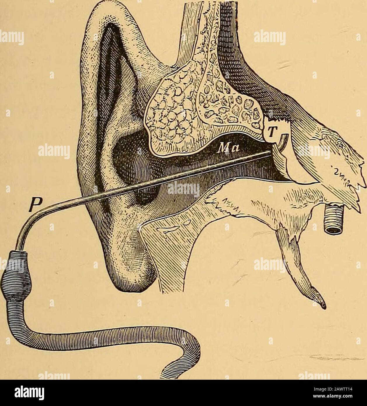 The diseases of the ear and their treatment . ly the treatment with ...