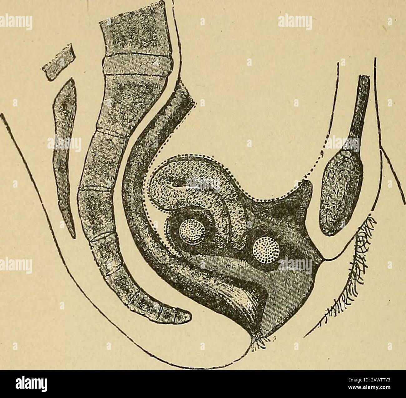 Retroflexed Vs Retroverted Uterus