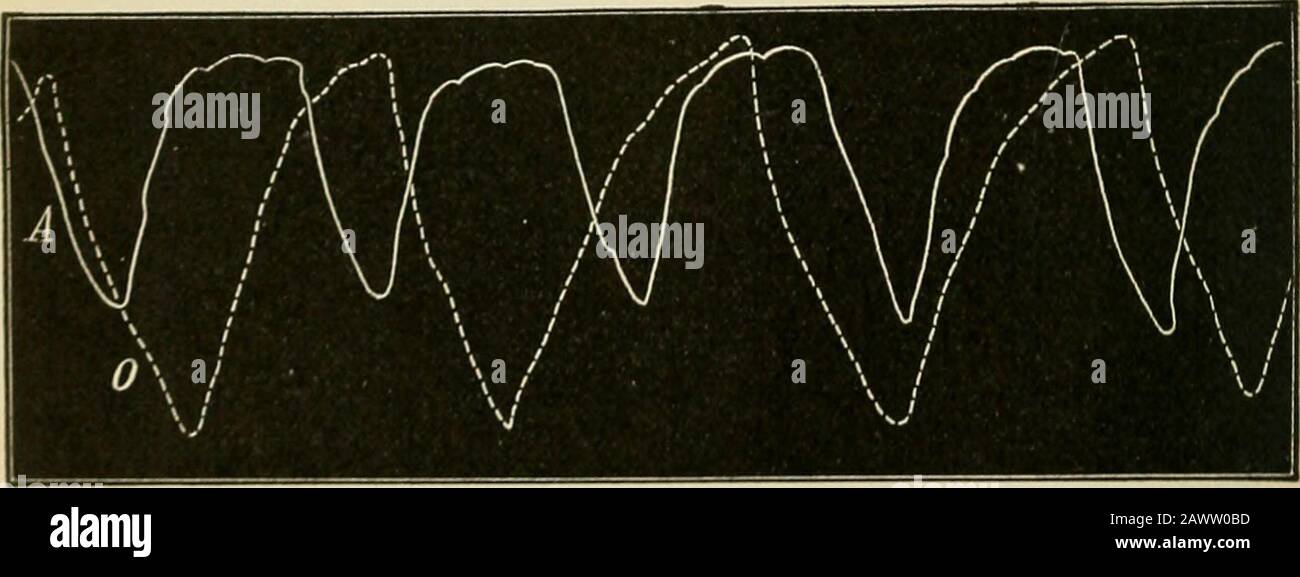 Pneumograph High Resolution Stock Photography and Images - Alamy