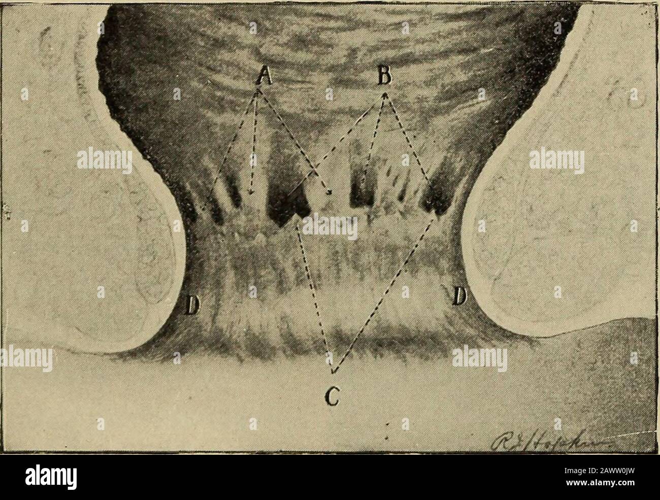 Pathology Diag High Resolution Stock Photography and Images - Alamy