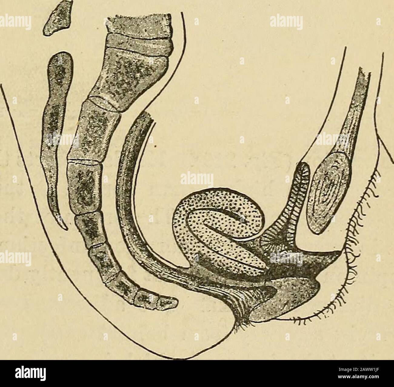 Treatise on gynæcology : medical and surgical . Fig. 217.—Anteflexion ...