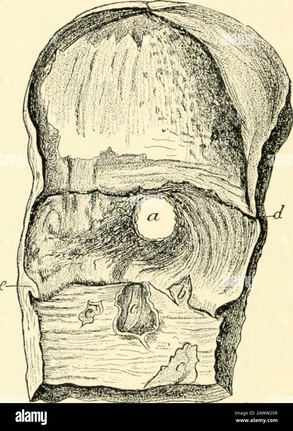 Mons veneris hi-res stock photography and images - Alamy