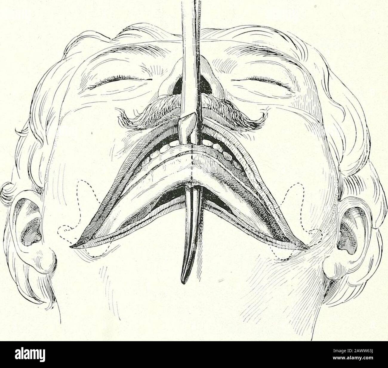 Surgical therapeutics and operative technique . FiG> 180.—-Relations of ...