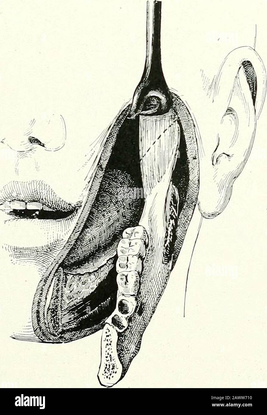 Inferior maxilla hi-res stock photography and images - Alamy