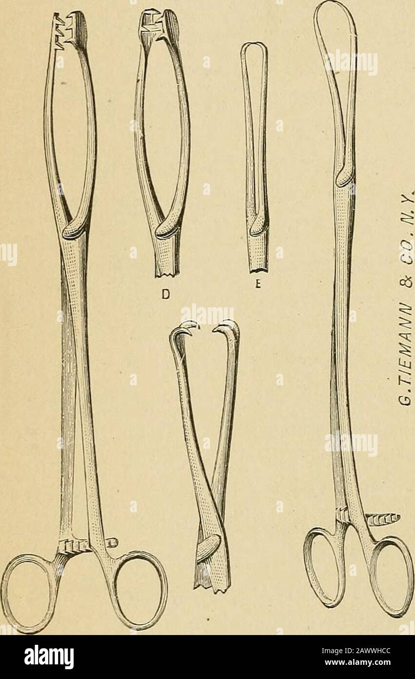 Treatise on gynæcology : medical and surgical . in the body of theorgan ...