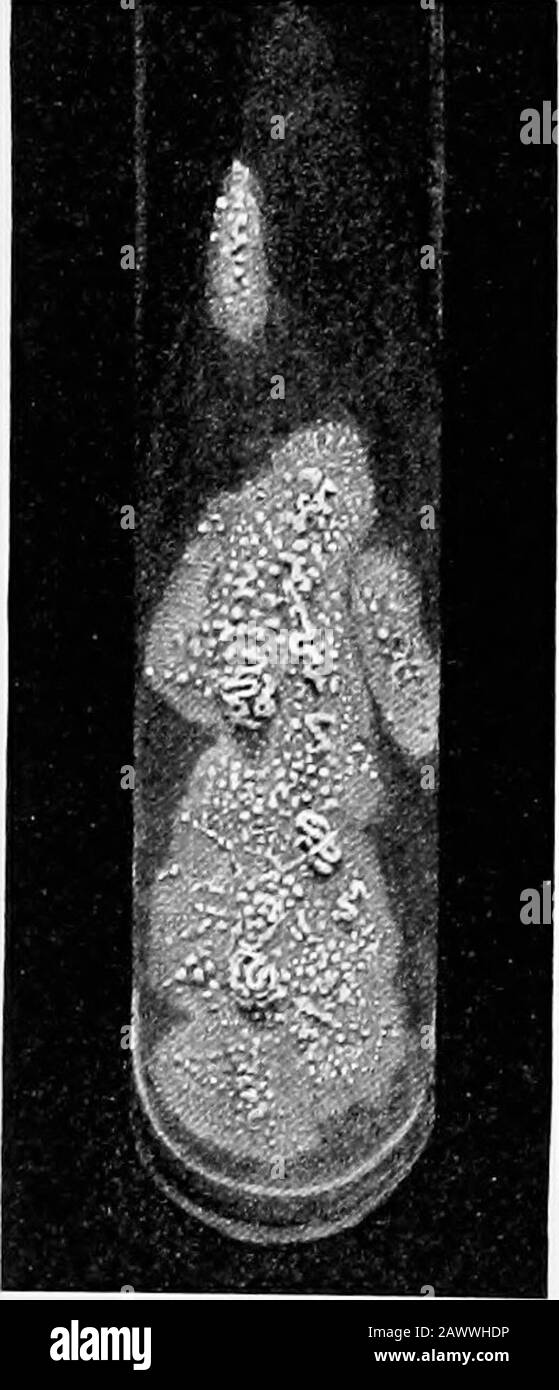 Waxy substance Black and White Stock Photos & Images - Alamy