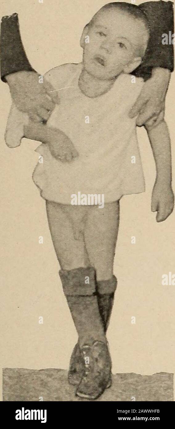 Valgus knee hi-res stock photography and images - Alamy