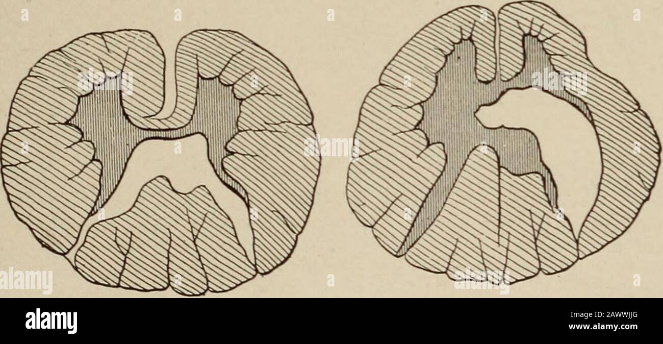 Lumbar extension hi-res stock photography and images - Alamy