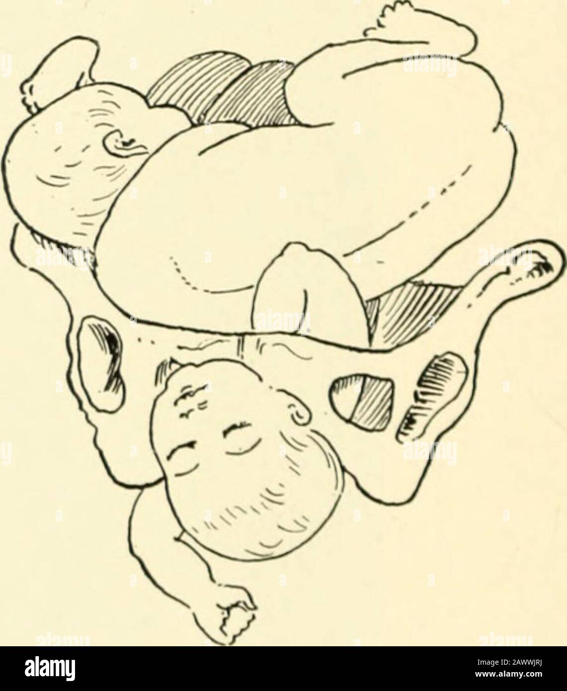 Human monstrosities hi-res stock photography and images - Alamy