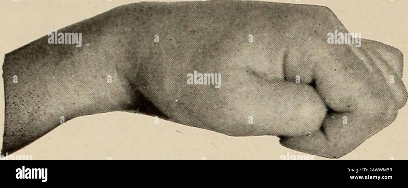 Nervous and mental diseases . emains. Under the actionof this ...