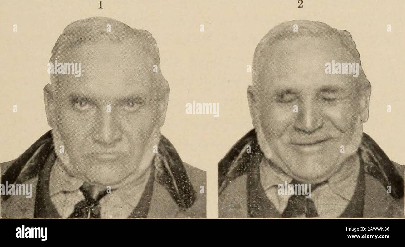 Nervous and mental diseases . expression andattempts at speech, that he ...