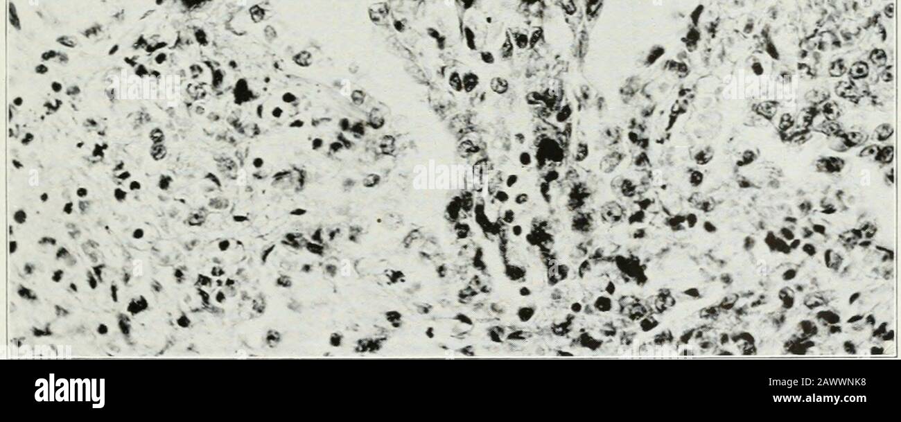 Archives of internal medicine . hown by the spaces where the torn walls ...