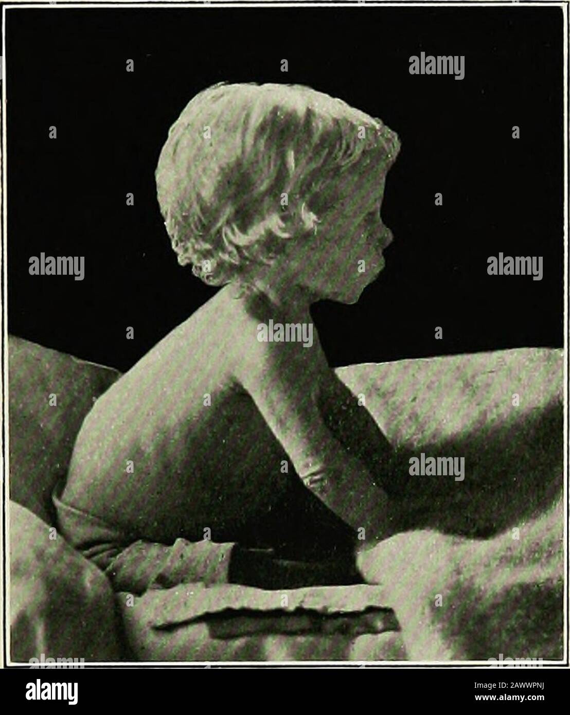 Rickets Head High Resolution Stock Photography and Images - Alamy