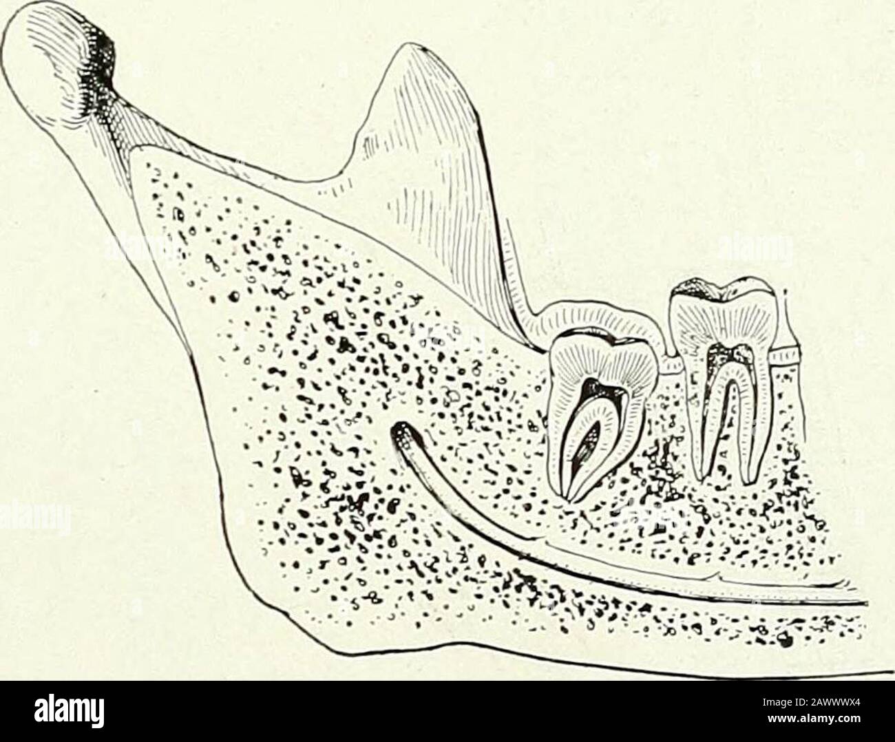 Tooth avulsion hi-res stock photography and images - Alamy
