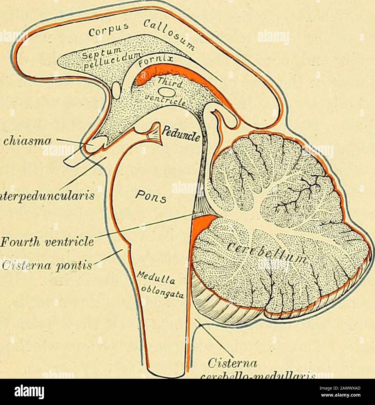 Arachnoid Granulations Histology