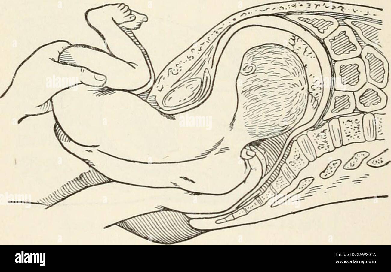 Arm pulled back hi-res stock photography and images - Alamy