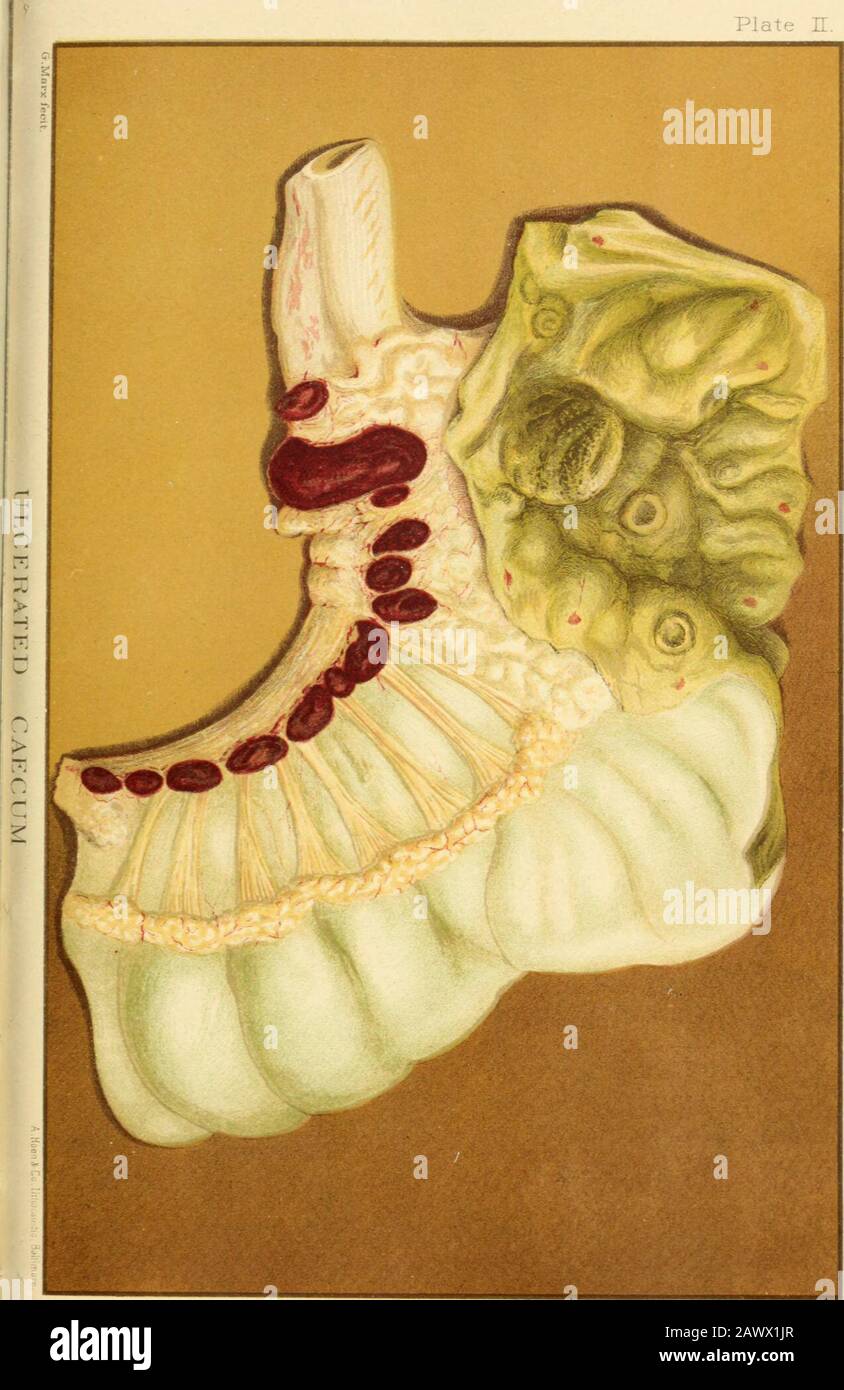 Hog cholera: its history, nature and treatment, as determined by the ...