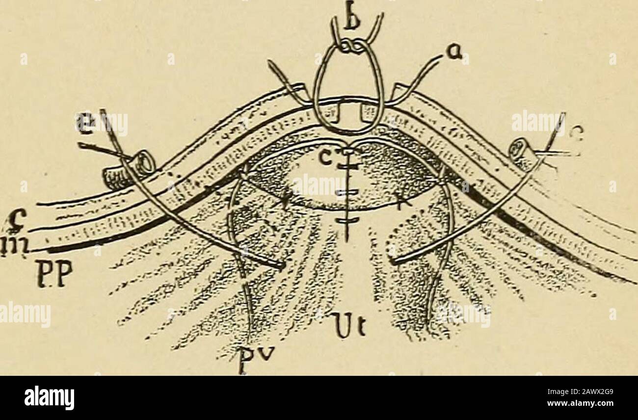 Treatise on gynæcology : medical and surgical . t the deeper surface of ...