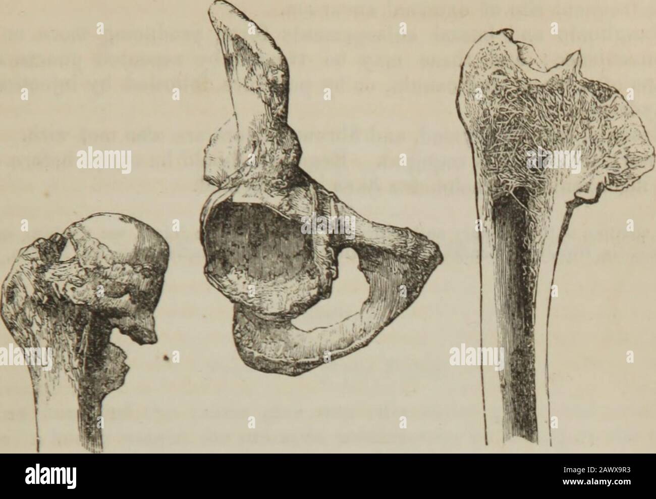 The practice of surgery . Cure of Morbus Coxaiiu.- by anchy-losis ...