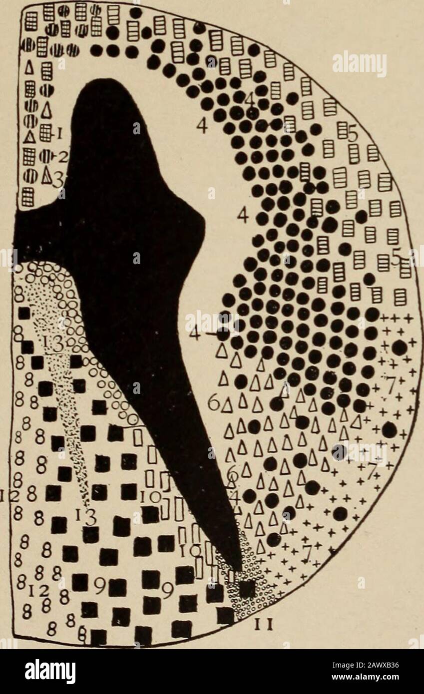 Nervous and mental diseases . Fig. 124.—Divisions of the cross-section ...