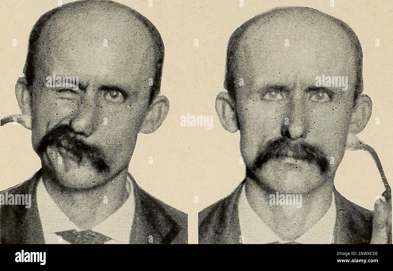 Nervous and mental diseases . ration, which ordi-narily involves other ...