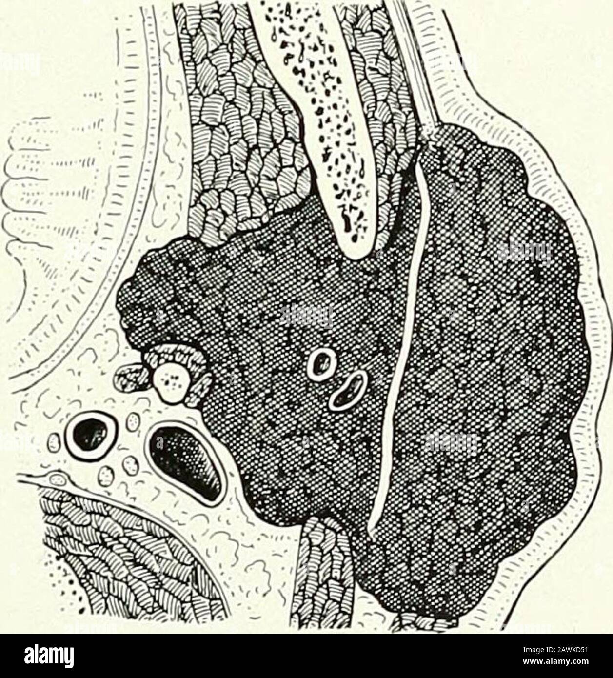 Parotid region hi-res stock photography and images - Alamy