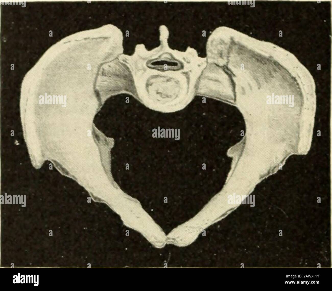 Tuberosi hi-res stock photography and images - Alamy