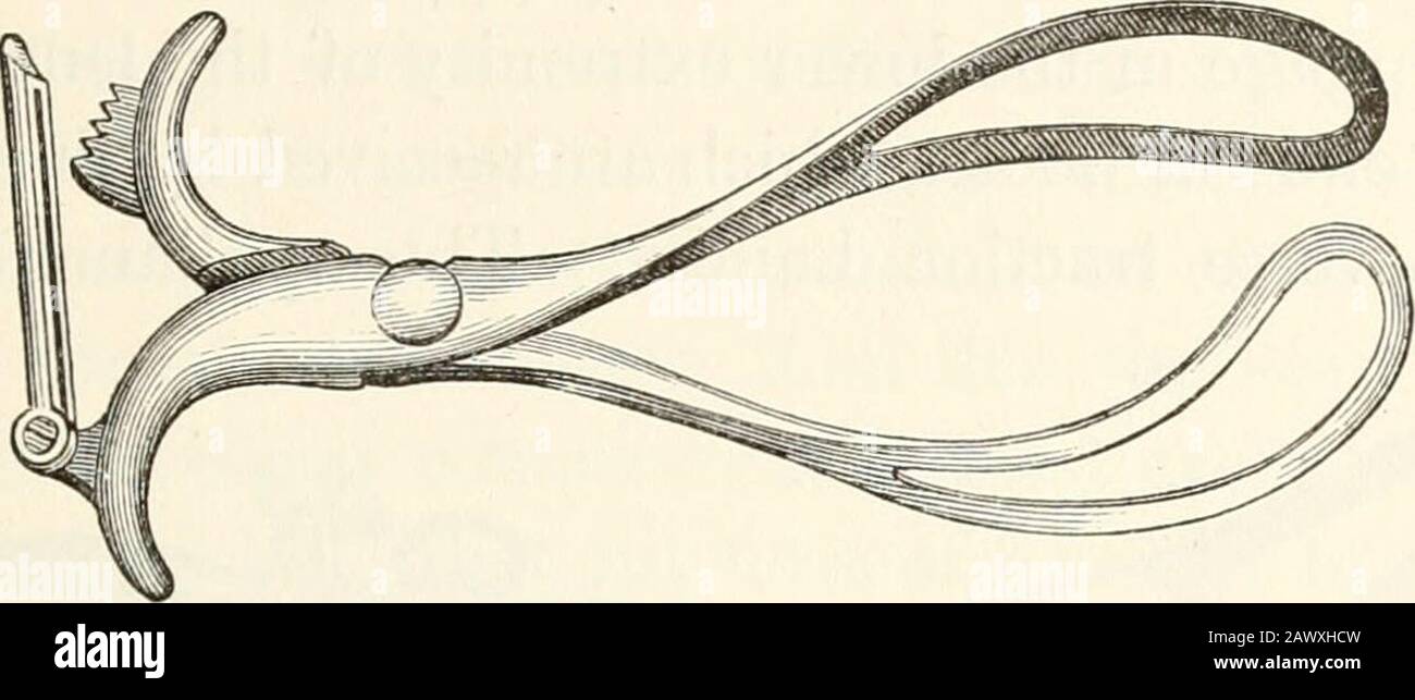 Obstetric instruments hi-res stock photography and images - Alamy