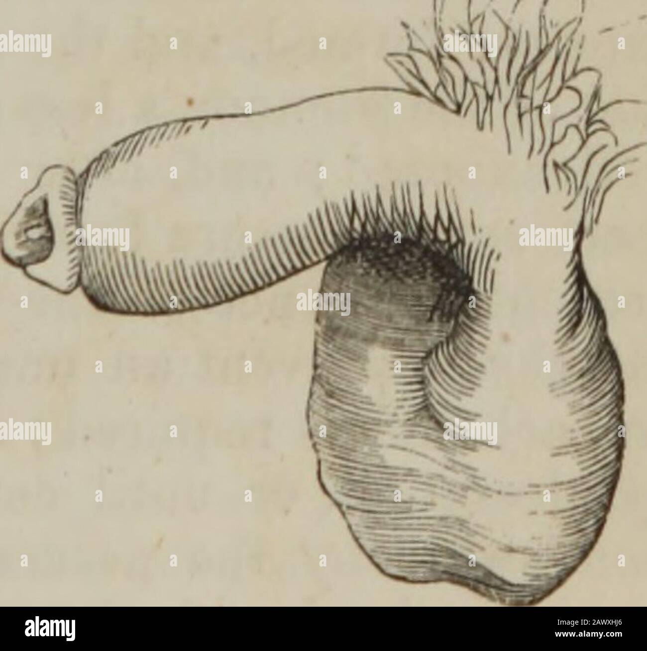 Balanitis hi-res stock photography and images - Alamy