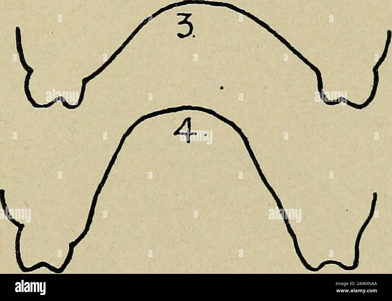 The etiology of osseous deformities of the head, face, jaws and teeth ...