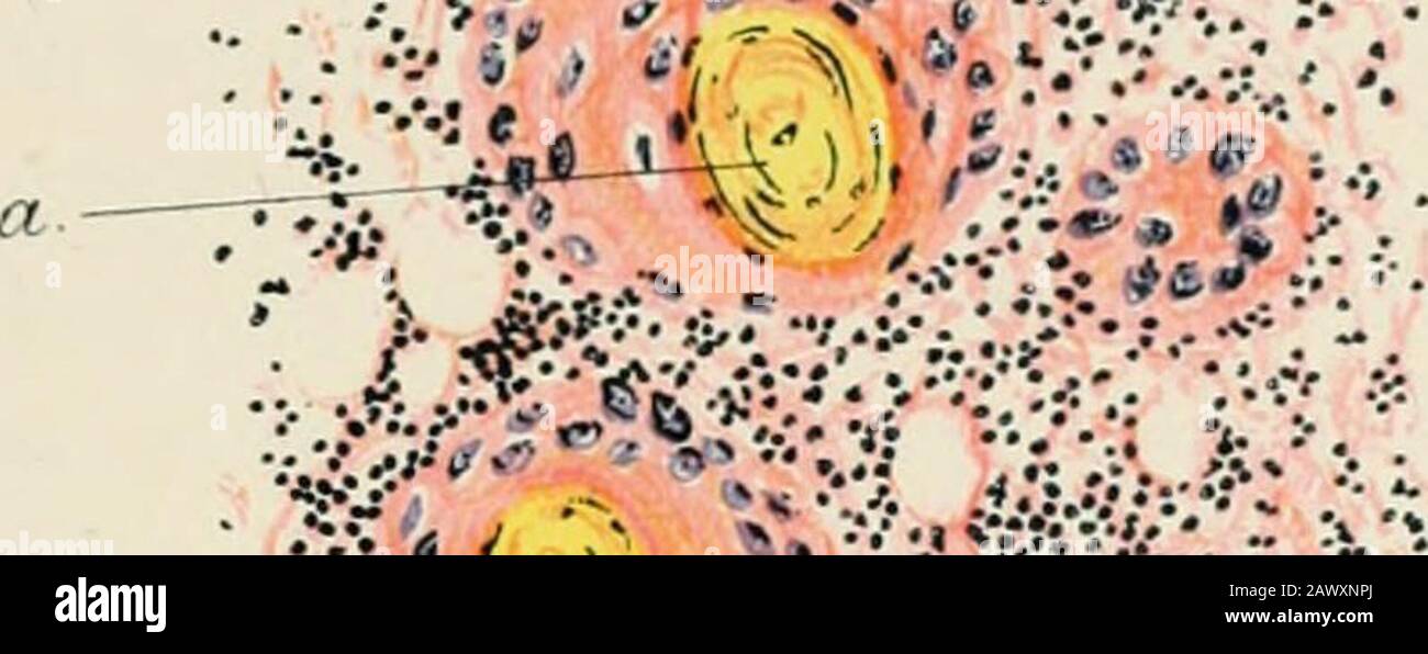 Practical pathology; a manual for students and practitioners . ng ...