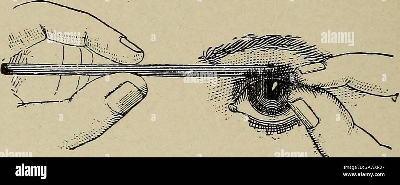 Neonatorum hi-res stock photography and images - Alamy