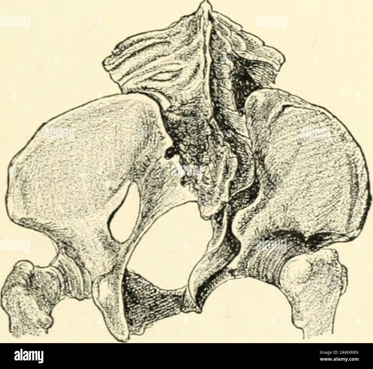 Symphysiotomy hi-res stock photography and images - Alamy