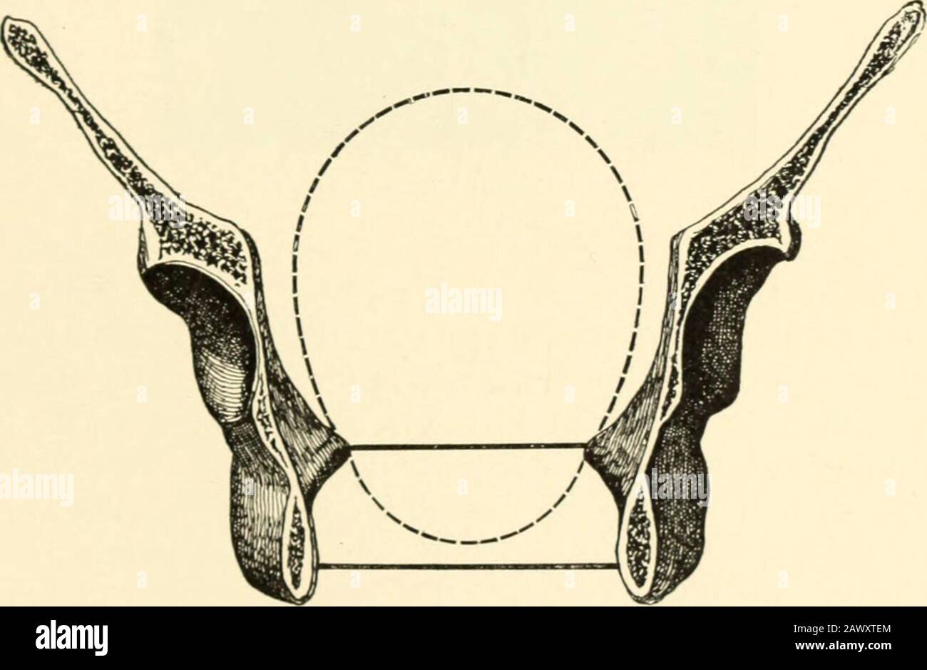 Occiput posterior hi-res stock photography and images - Alamy