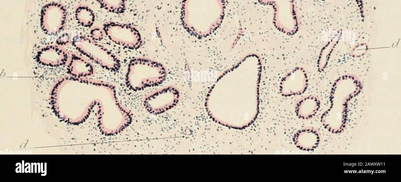 Mammary gland acini hi-res stock photography and images - Alamy