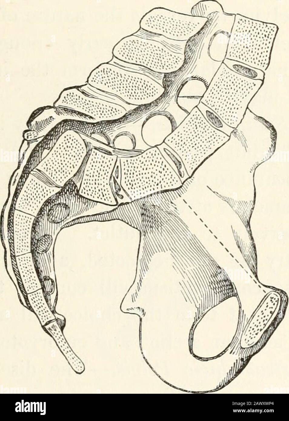 A text-book of practical obstetrics, comprising pregnancy, labor, and ...