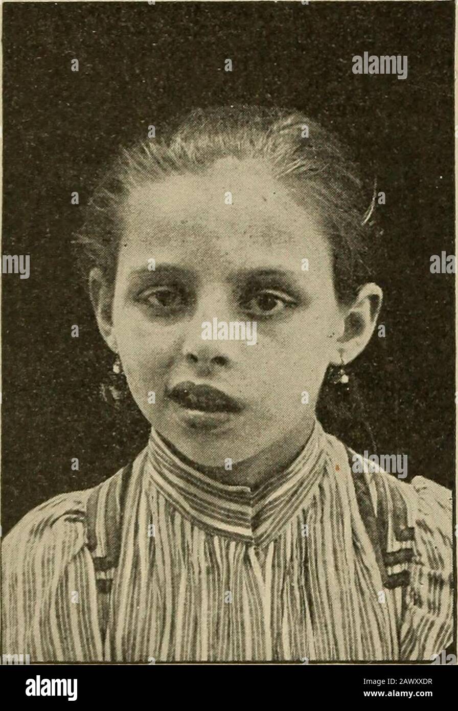 Sciatica d hi-res stock photography and images - Alamy