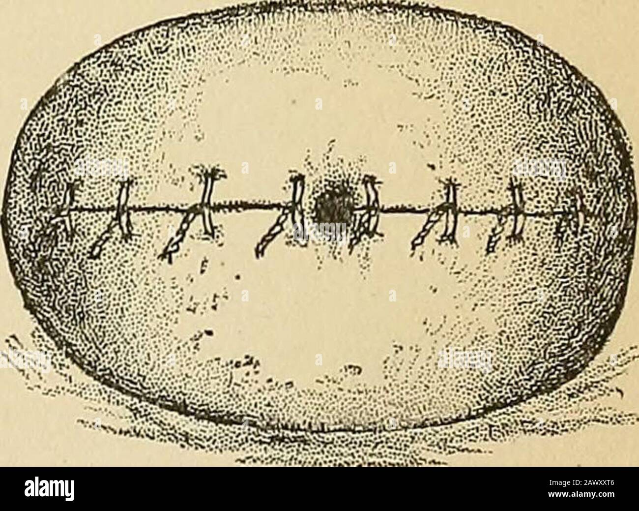 Treatise on gynæcology : medical and surgical . [Fig. 135.—Diagram ...