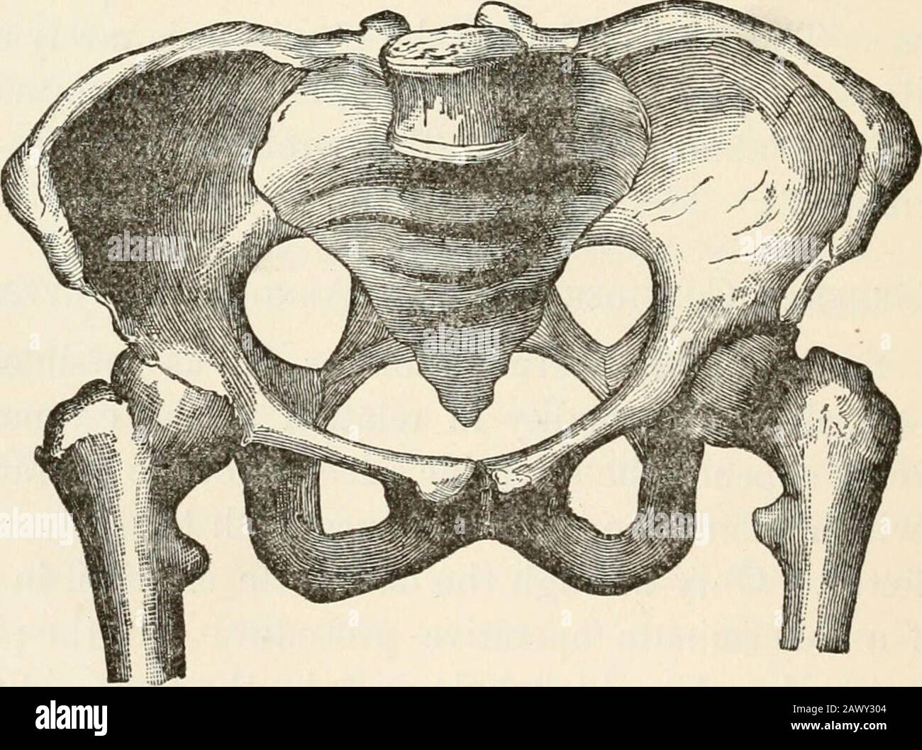 Marasmus hi-res stock photography and images - Alamy