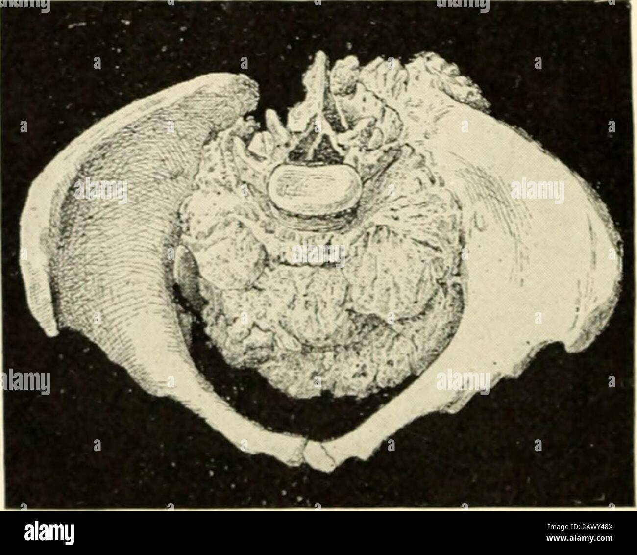 Pelvicbone hi-res stock photography and images - Alamy