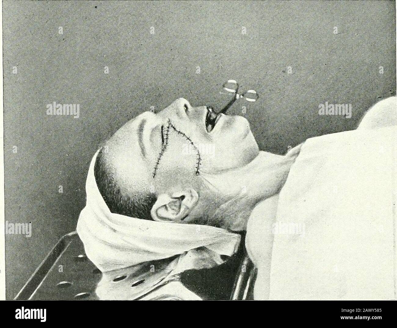 Nerve fibres hi-res stock photography and images - Alamy