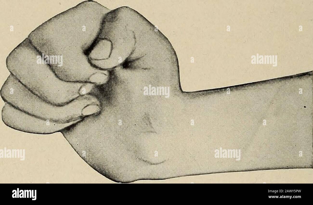 Nervous and mental diseases . he cord is produced spastic ...