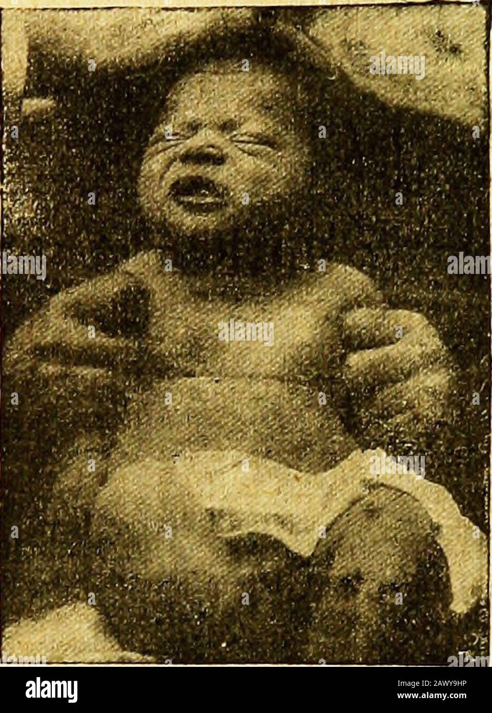 Malaxation hi-res stock photography and images - Alamy