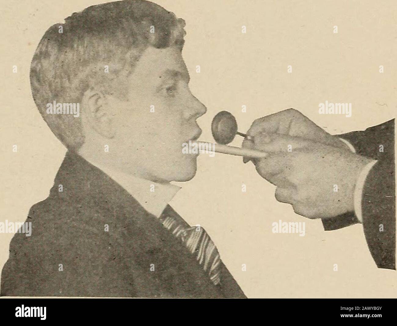 Nervous and mental diseases . l reflex hasbeen described by McCarthy.It ...