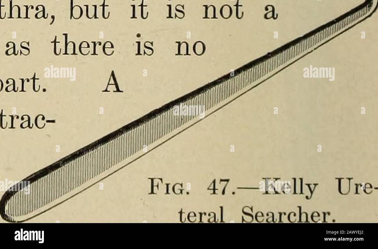 Gynecological diagnosis . Fig. 47.—Kelly Ure-teral Searcher. ANATOMY ...