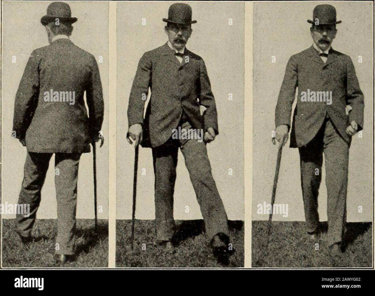 Paretic hi-res stock photography and images - Alamy