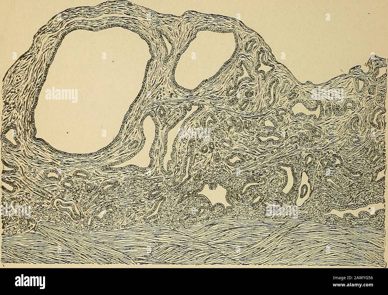 Treatise on gynæcology : medical and surgical . orm of combined ...