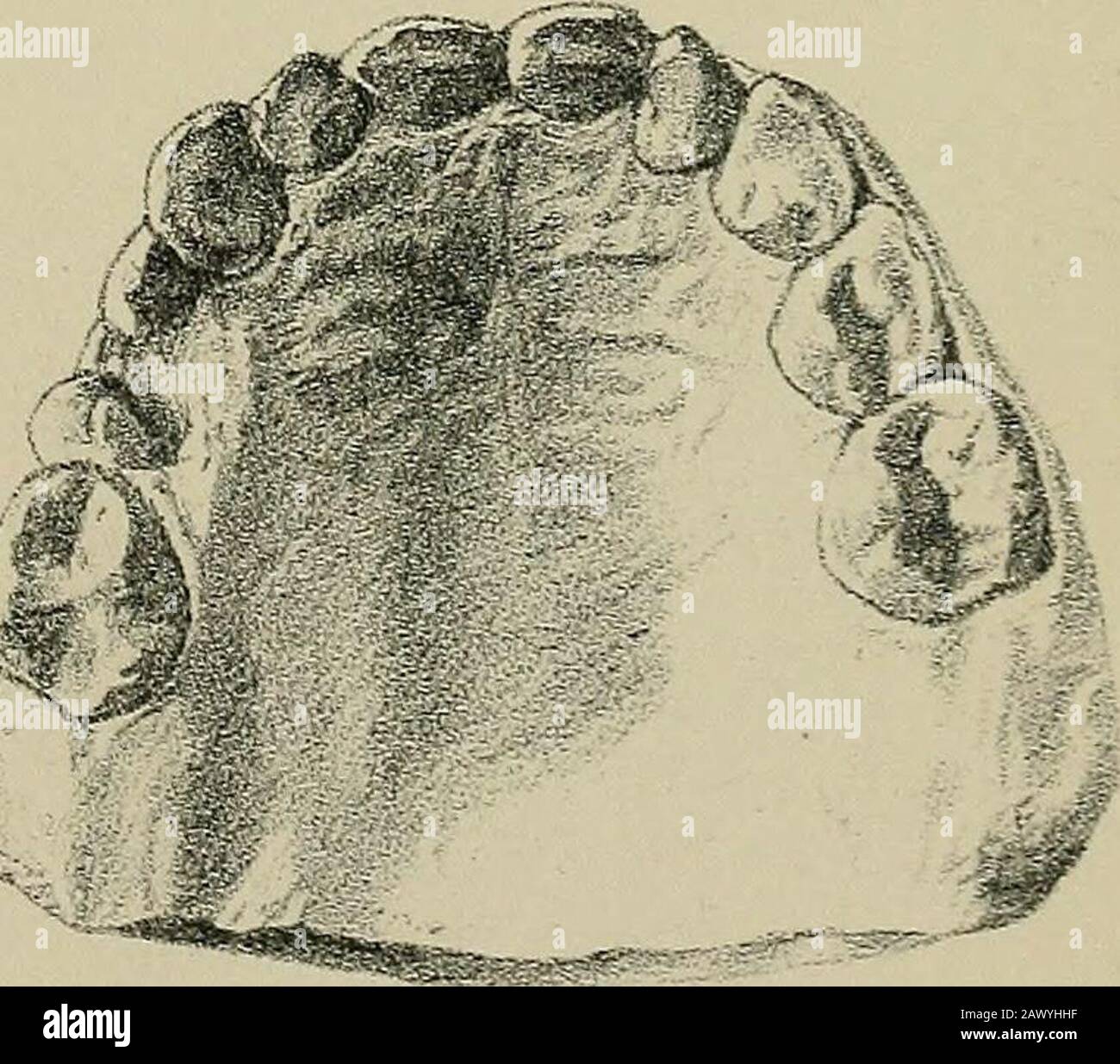 The etiology of osseous deformities of the head, face, jaws and teeth ...