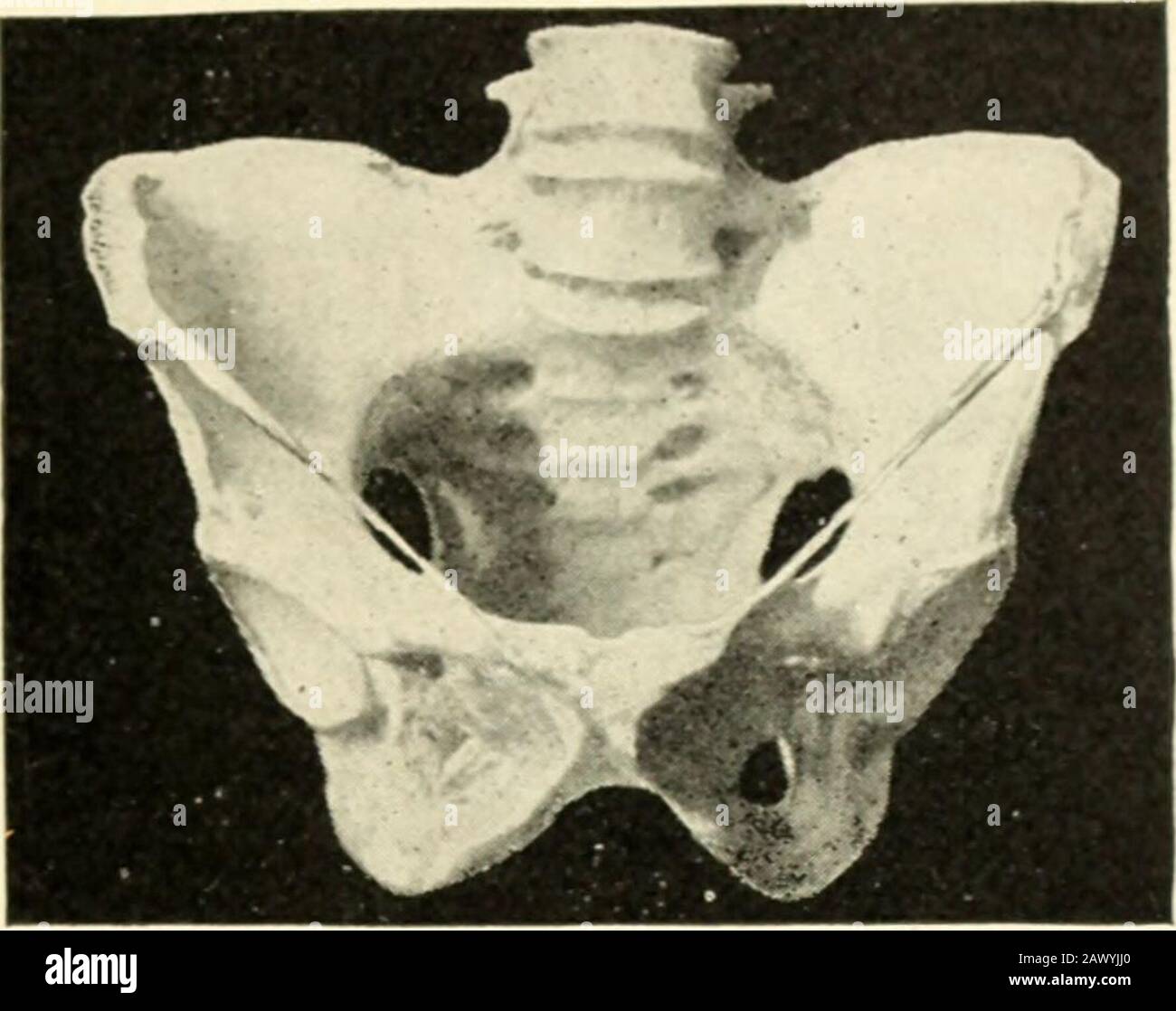 A textbook of obstetrics . tors : the pressure from the trunk aboveand ...